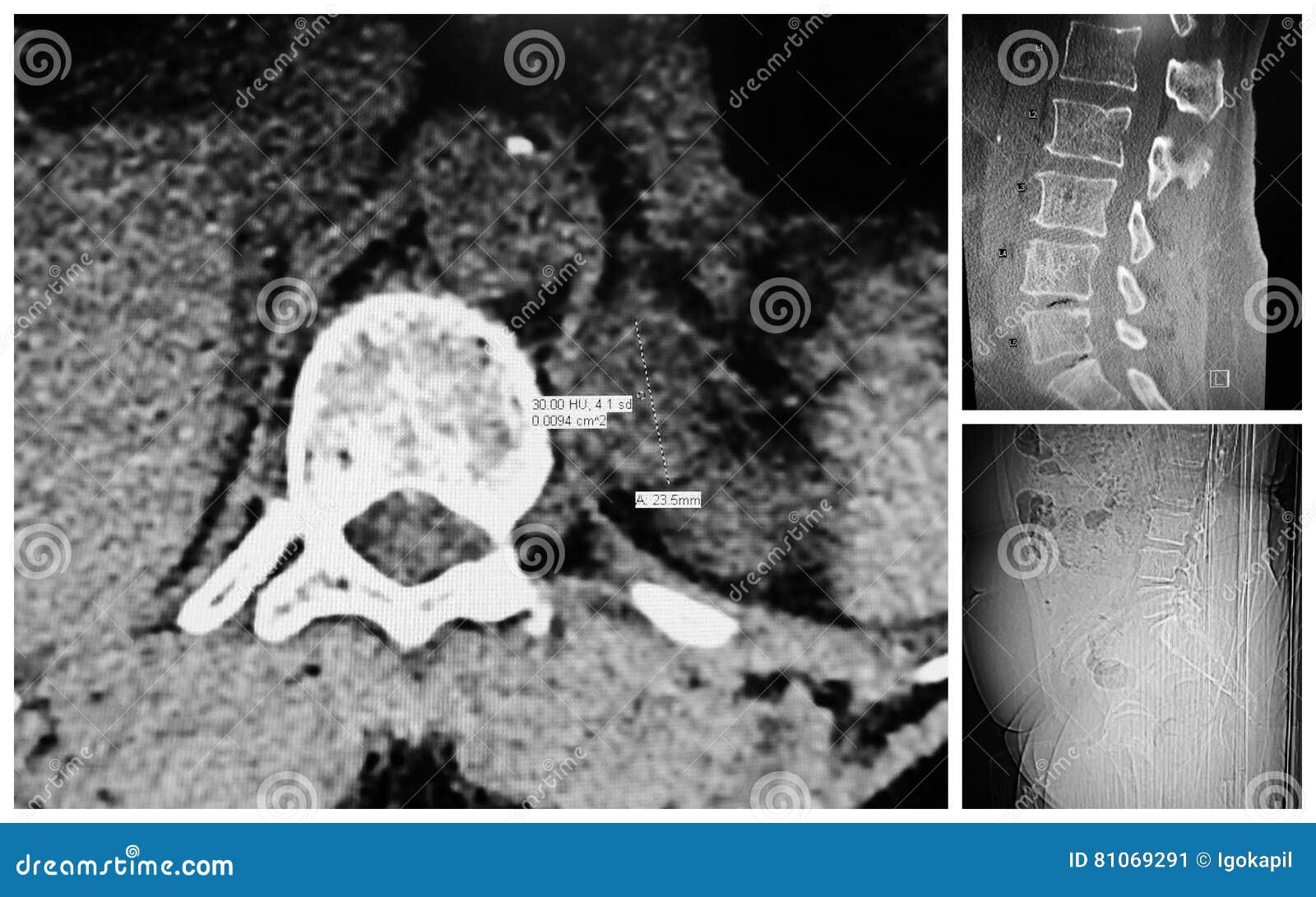 306 Orthopedic Collage Stock Photos - Free & Royalty-Free Stock Photos ...