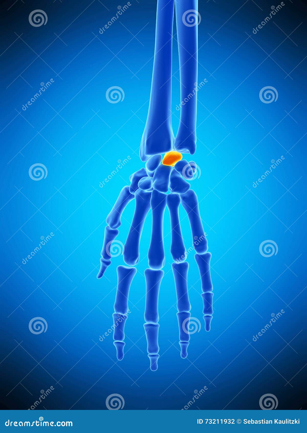 The lunate bone stock illustration. Illustration of posterior - 73211932