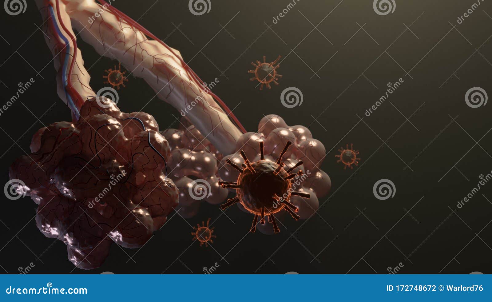 Lung Alveoli and Corona Virus Infection Stock Illustration ...