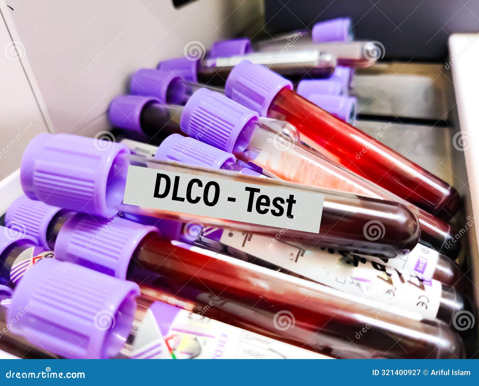 Blood Sample for DLCO Test. Stock Image - Image of rendering ...