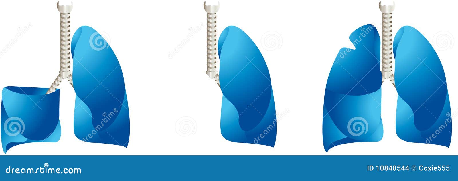 Chest X-ray Lobectomy Stock Photo | CartoonDealer.com #115431318