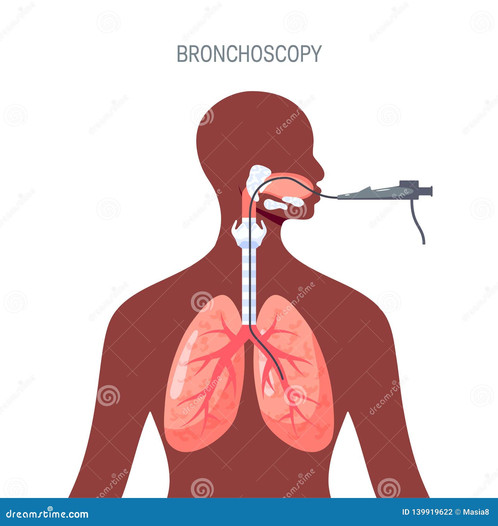 Bronchoscopy Respiratory System Emphysema Endoscopy Human Lung ...
