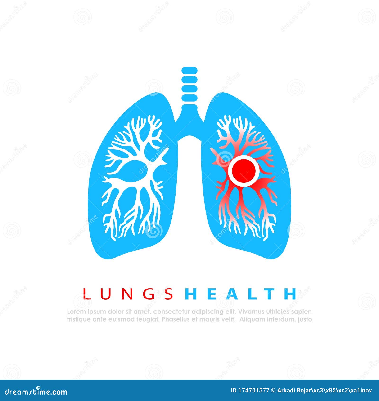 Lungs Infection Vector Logo | CartoonDealer.com #174701577