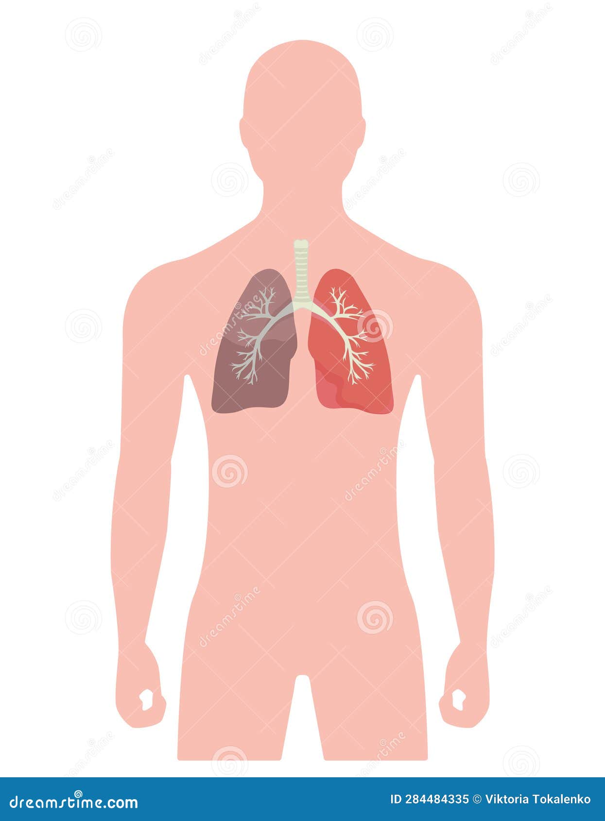 Lungs of a Sick Person Sick Lungs with a Trachea on a Human Background ...