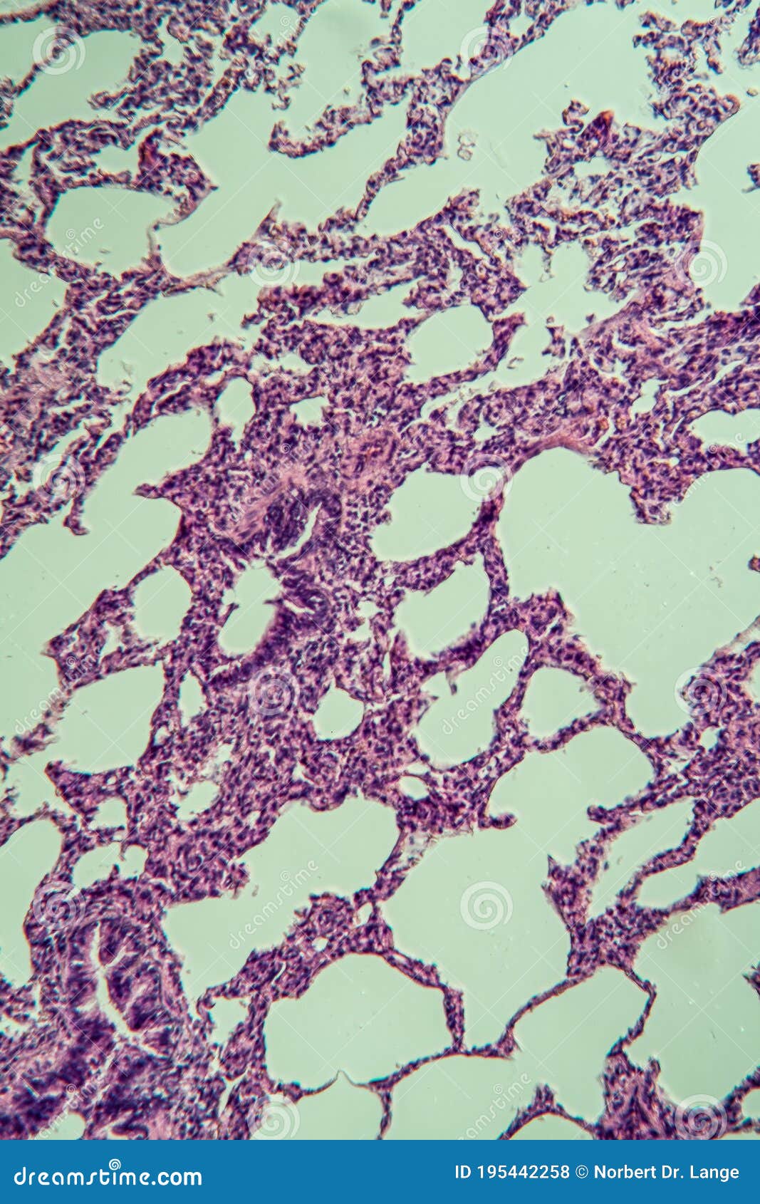 Trachea Slide Microscope