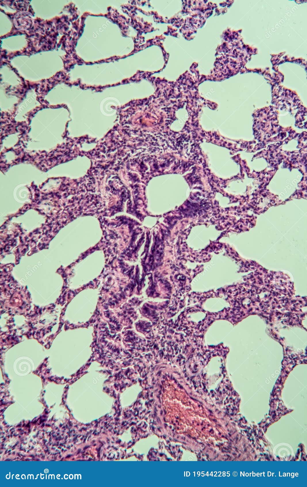 Lungs under the microscope stock image. Image of magnification - 195442285