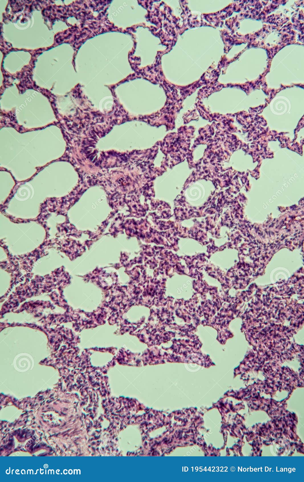 Lungs under the microscope stock photo. Image of research - 195442322