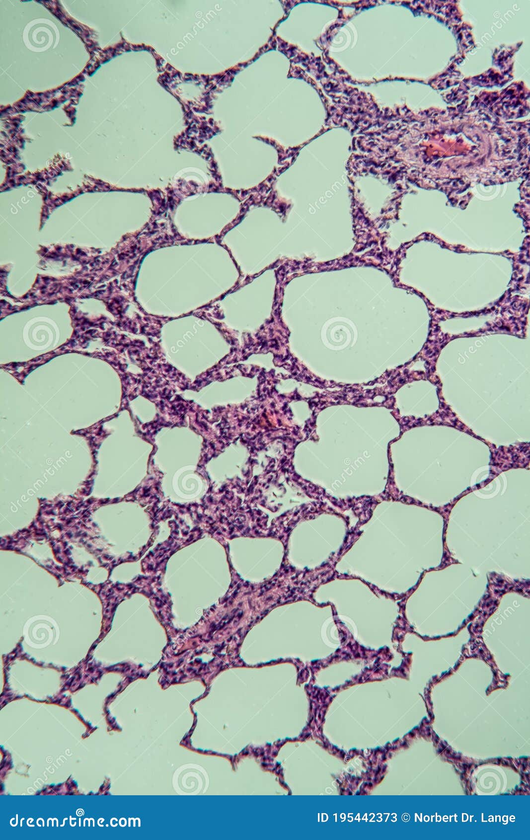 Lungs under the microscope stock image. Image of research - 195442373