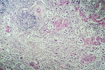 Lungworm Under the Microscope Stock Photo - Image of roebuck, lungworm ...