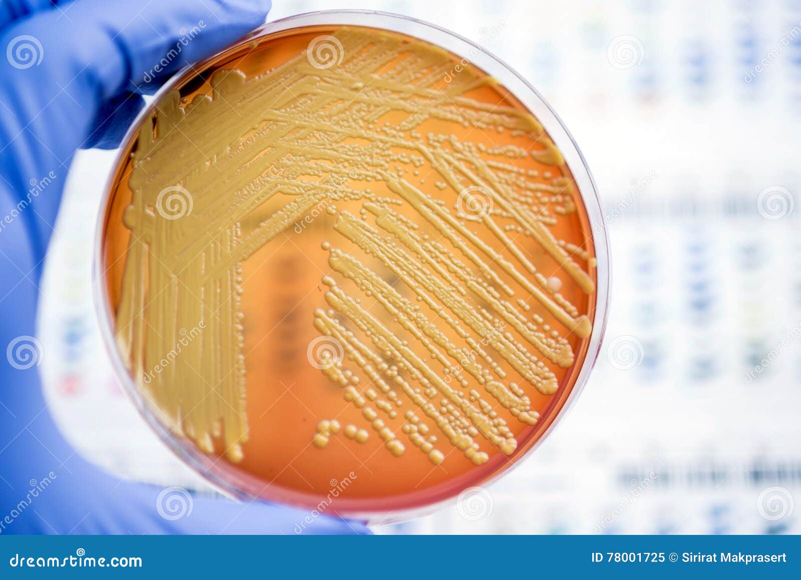 Luteus del micrococo imagen de archivo. Imagen de medicina - 78001725