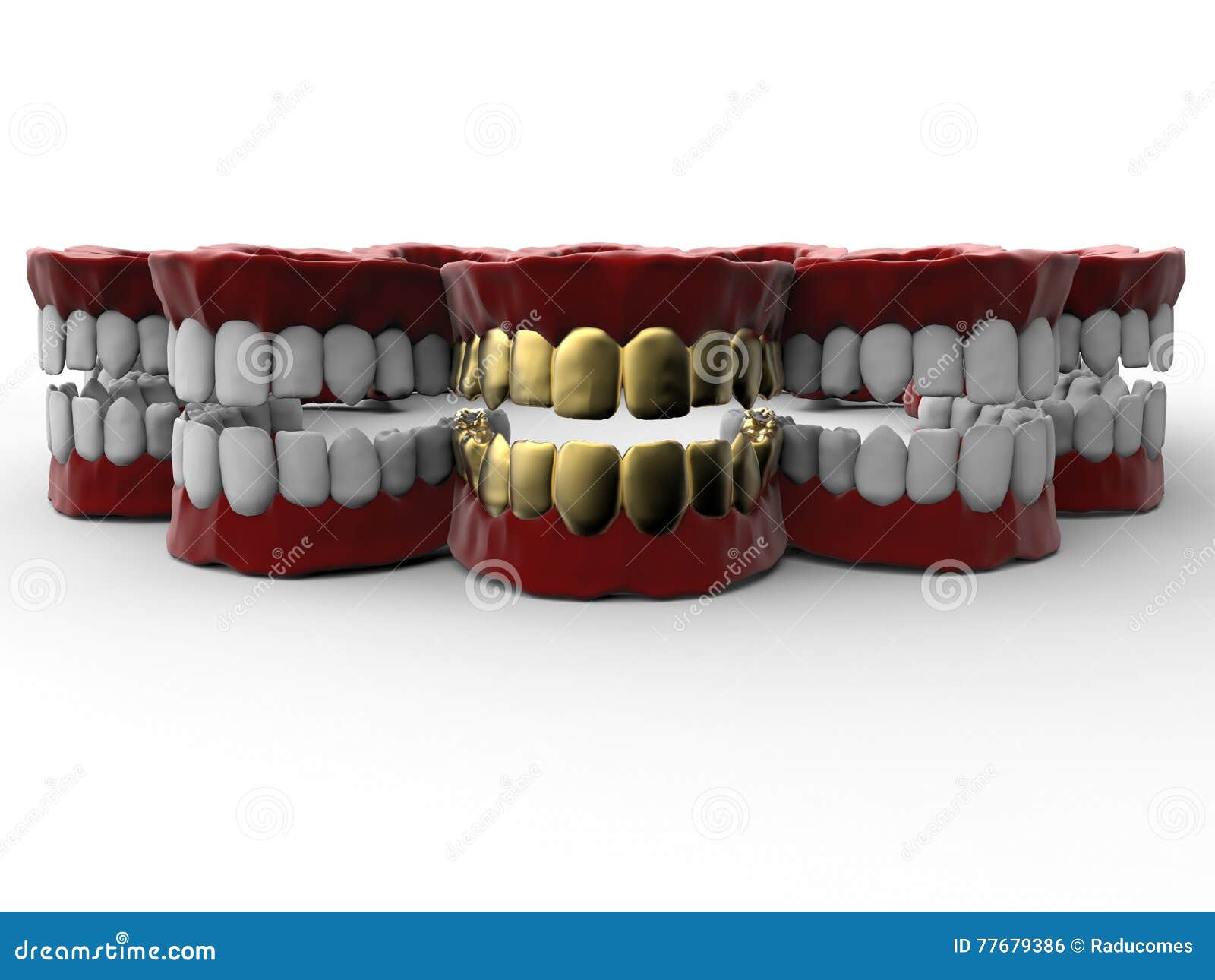 Denture Concept - Healthy Teeth With Fixed Dental Bridgework And ...