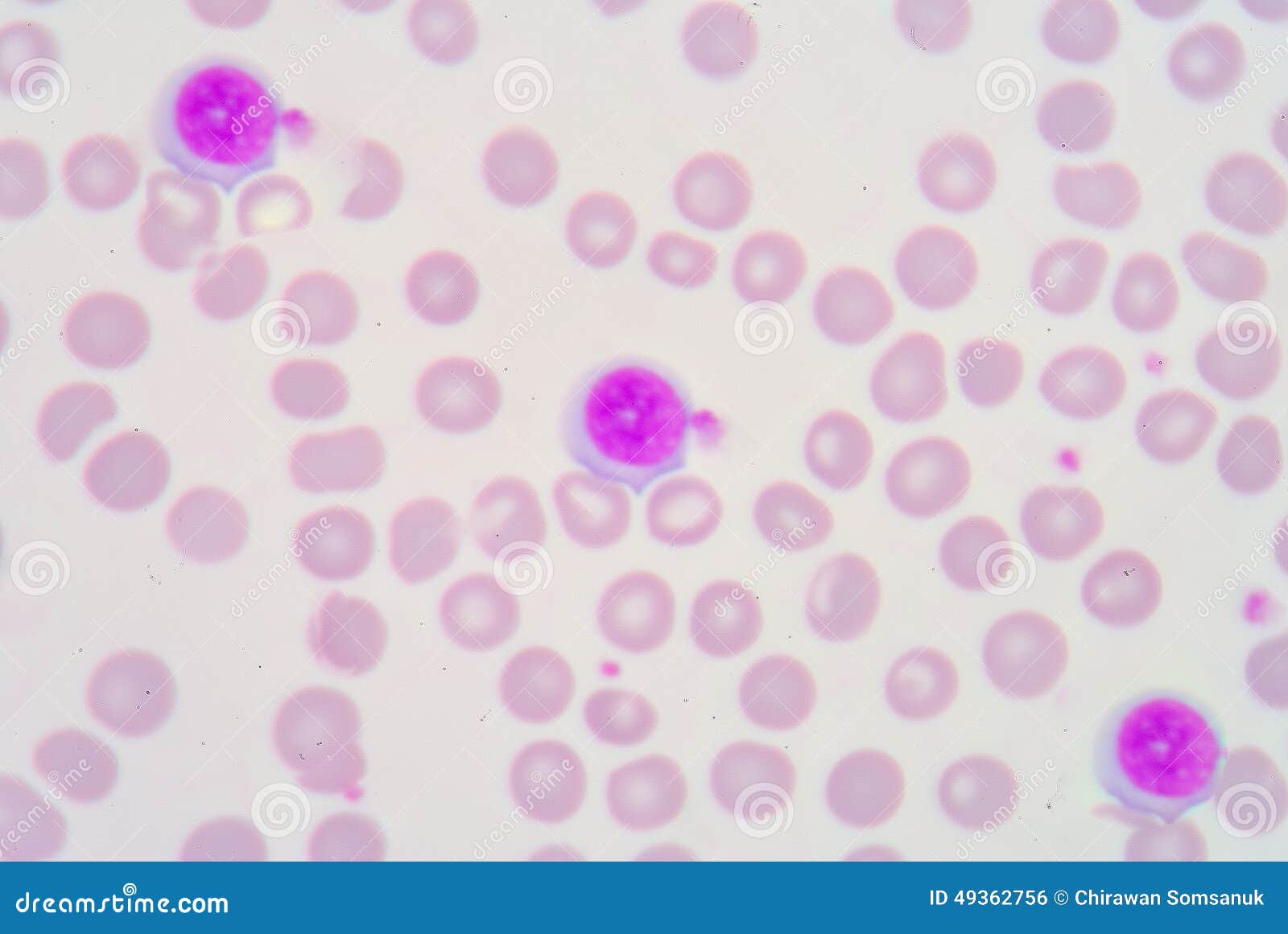 Lymfocyt stock foto. Image of geneeskunde, leukocyt, ziekte - 49362756