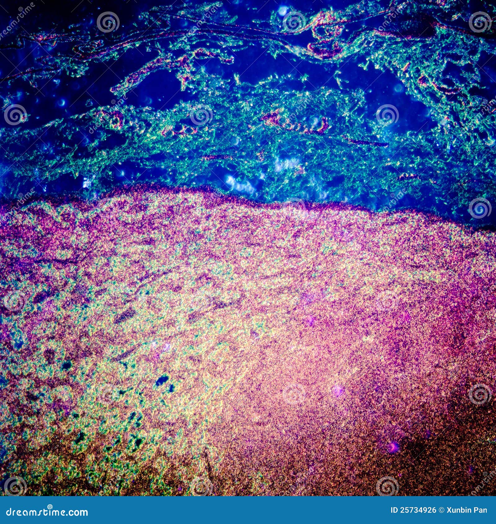 Lymph gland tissue stock photo. Image of biology, lymphocyte - 25734926