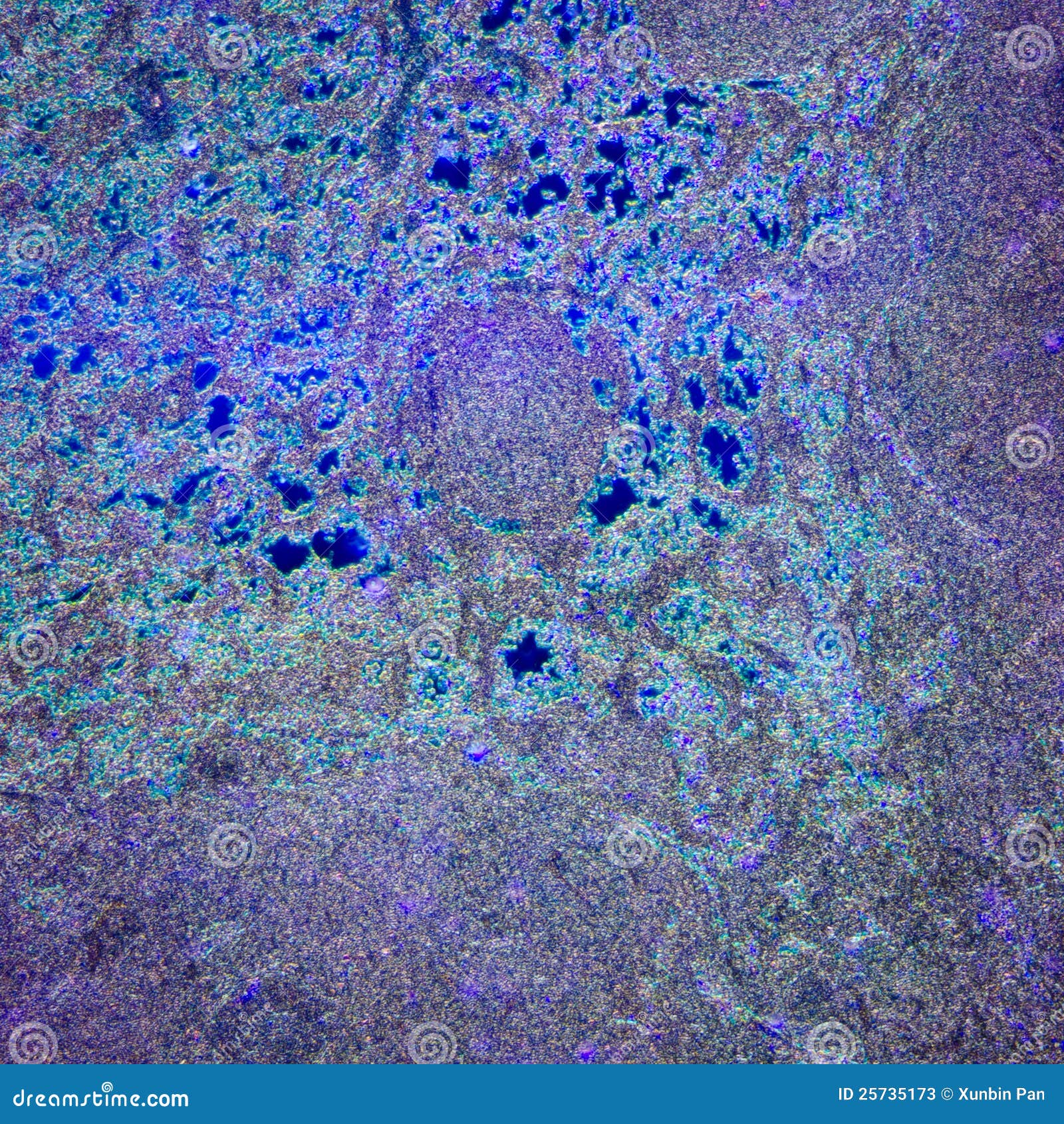 Lymph gland tissue stock image. Image of lymph, medical - 25735173