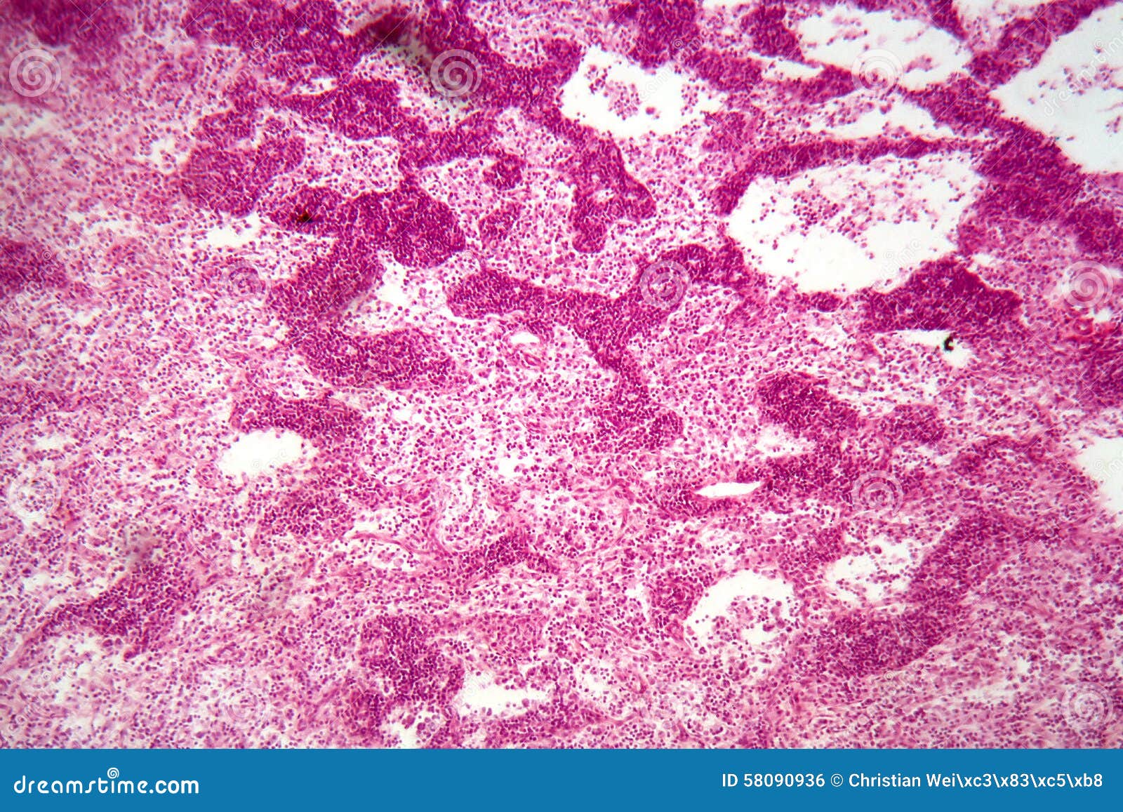 Lymph Node Cells Under The Microscope. Royalty-Free Stock Image ...