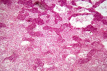 Lymph Node Cells Under the Microscope. Stock Photo - Image of organic ...