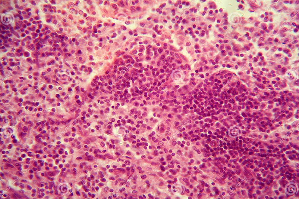 Lymph Node Cells Under the Microscope. Stock Photo - Image of micro ...
