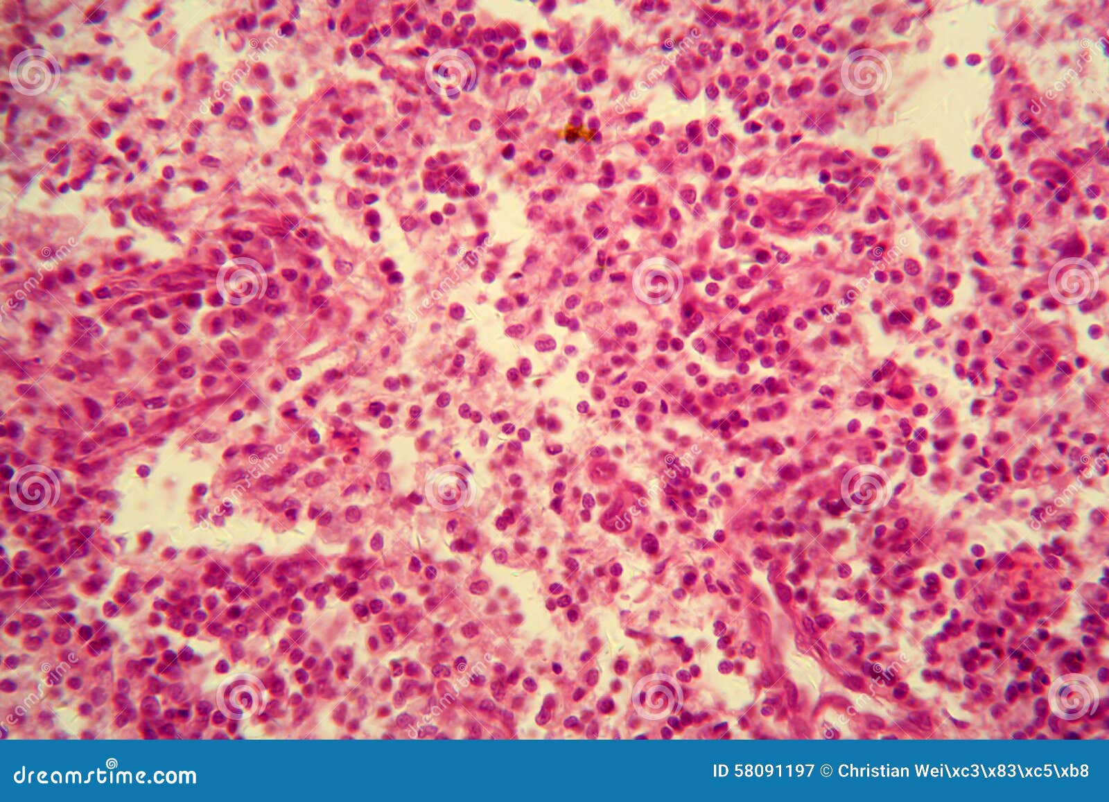 Lymph Node Cells Under the Microscope. Stock Image - Image of ...