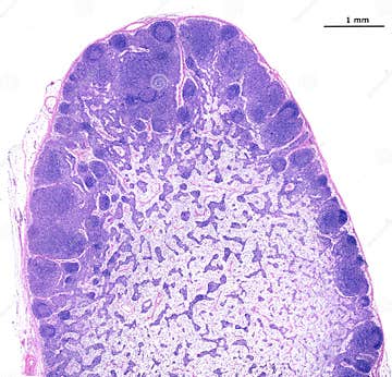 Lymph node stock image. Image of microscope, cortex - 288379491