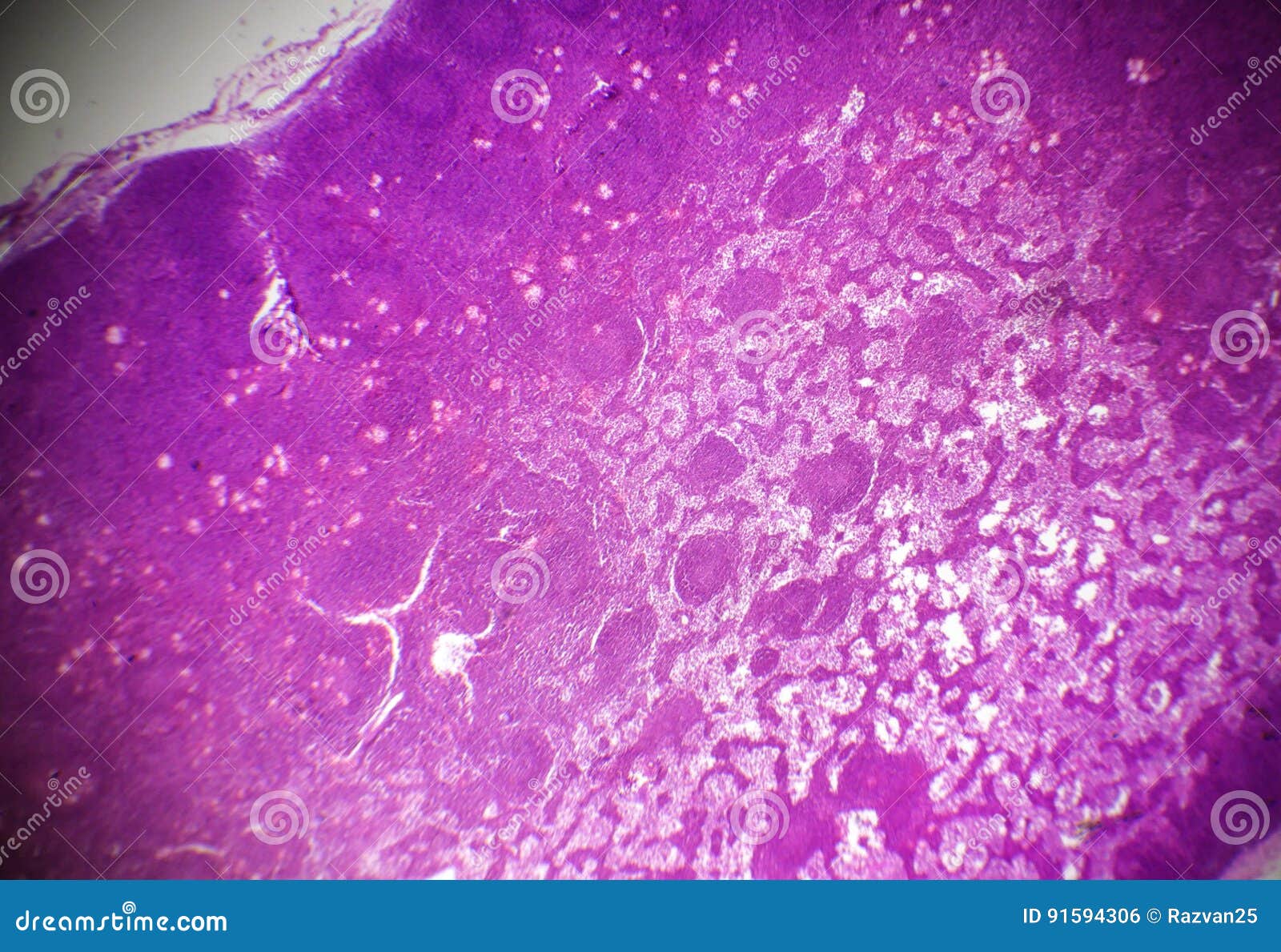Lymph Node Cells Under The Microscope. Royalty-Free Stock Image ...