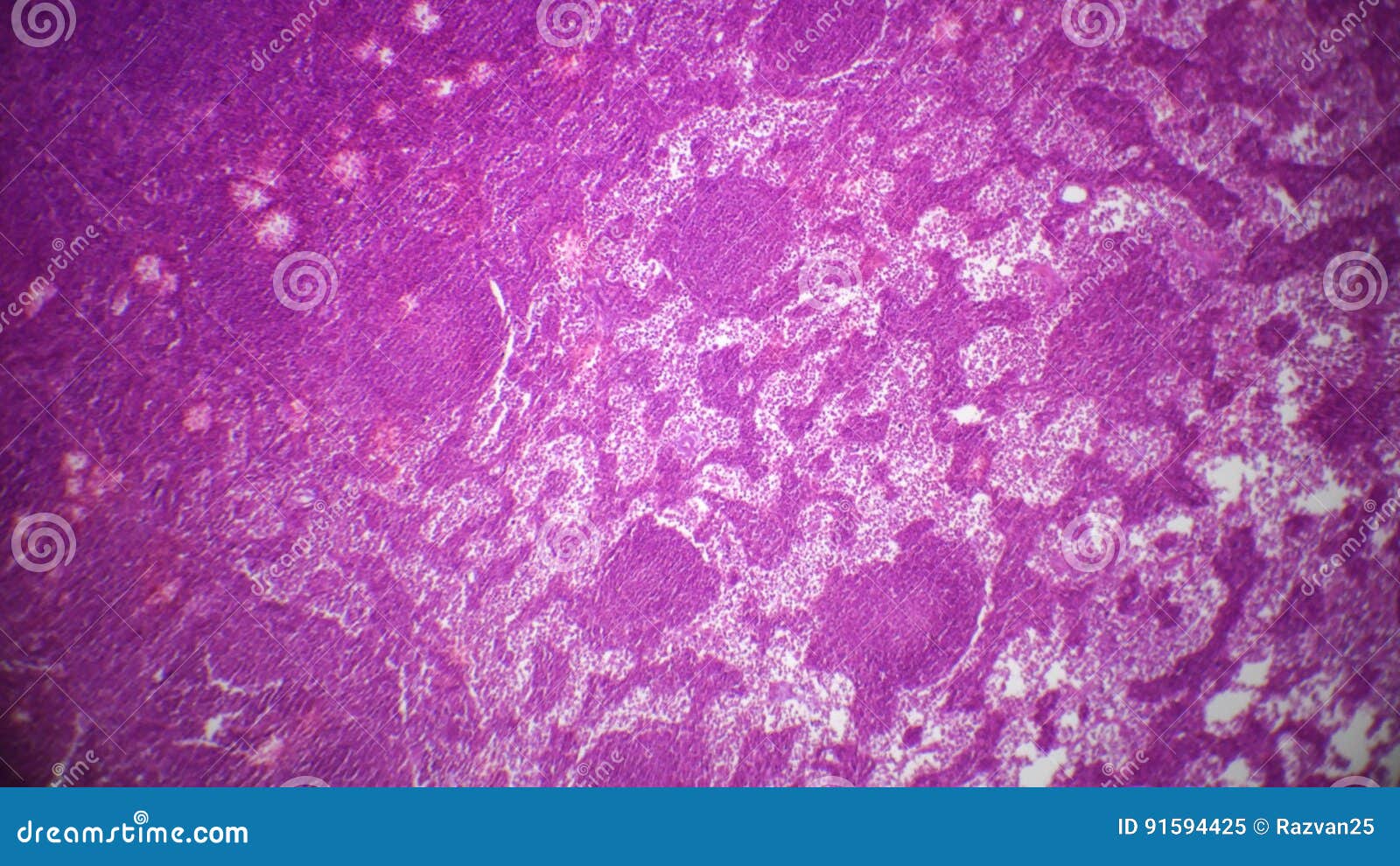 Lymph Node Section Under the Microscope Stock Image - Image of ...