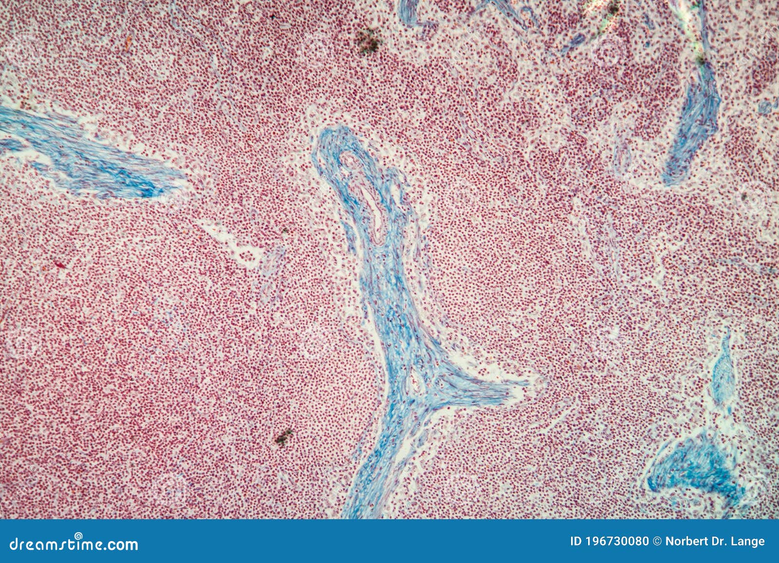 Lymph node tissue stock photo. Image of tissue, science - 196730080
