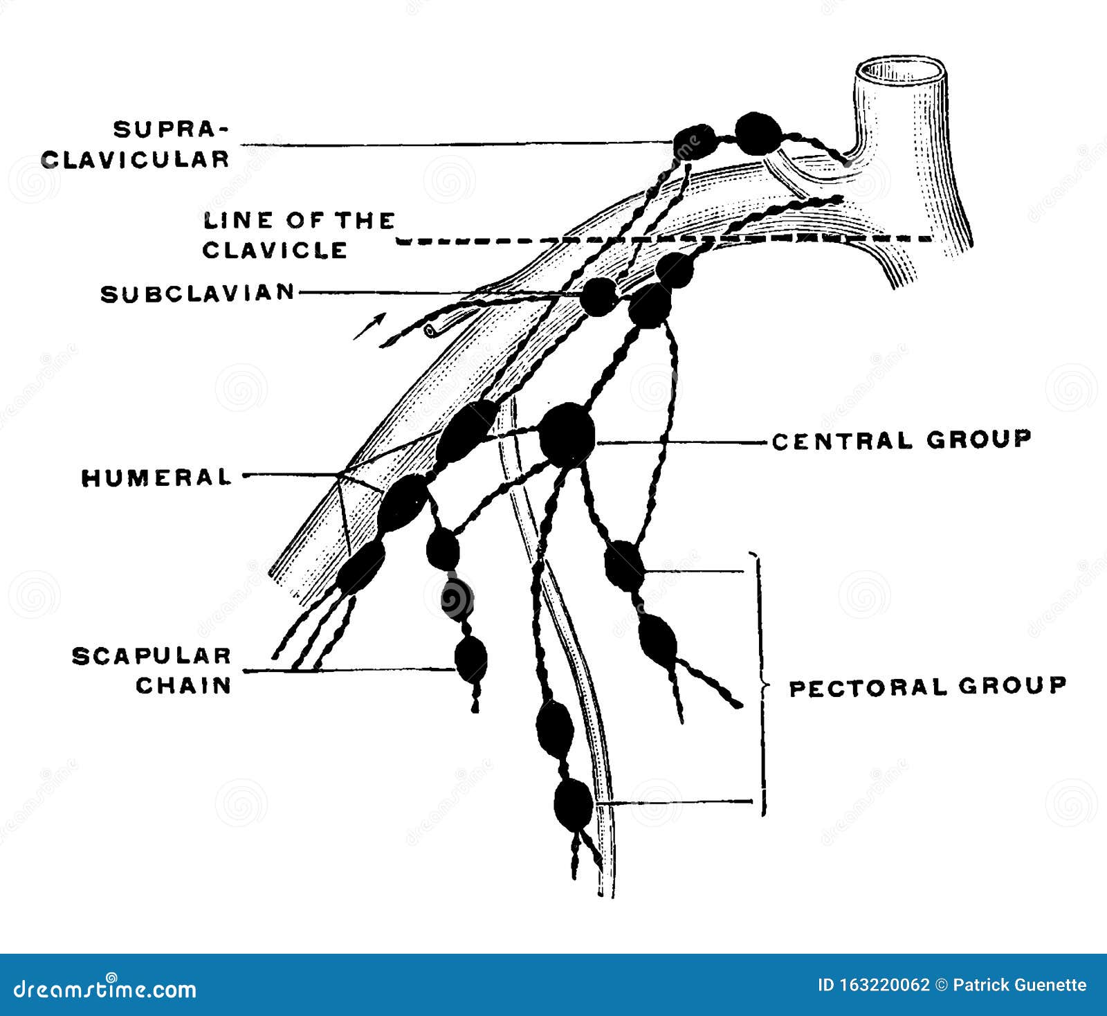 Lymph Node of Upper Extremity, Vintage Illustration Stock Vector ...