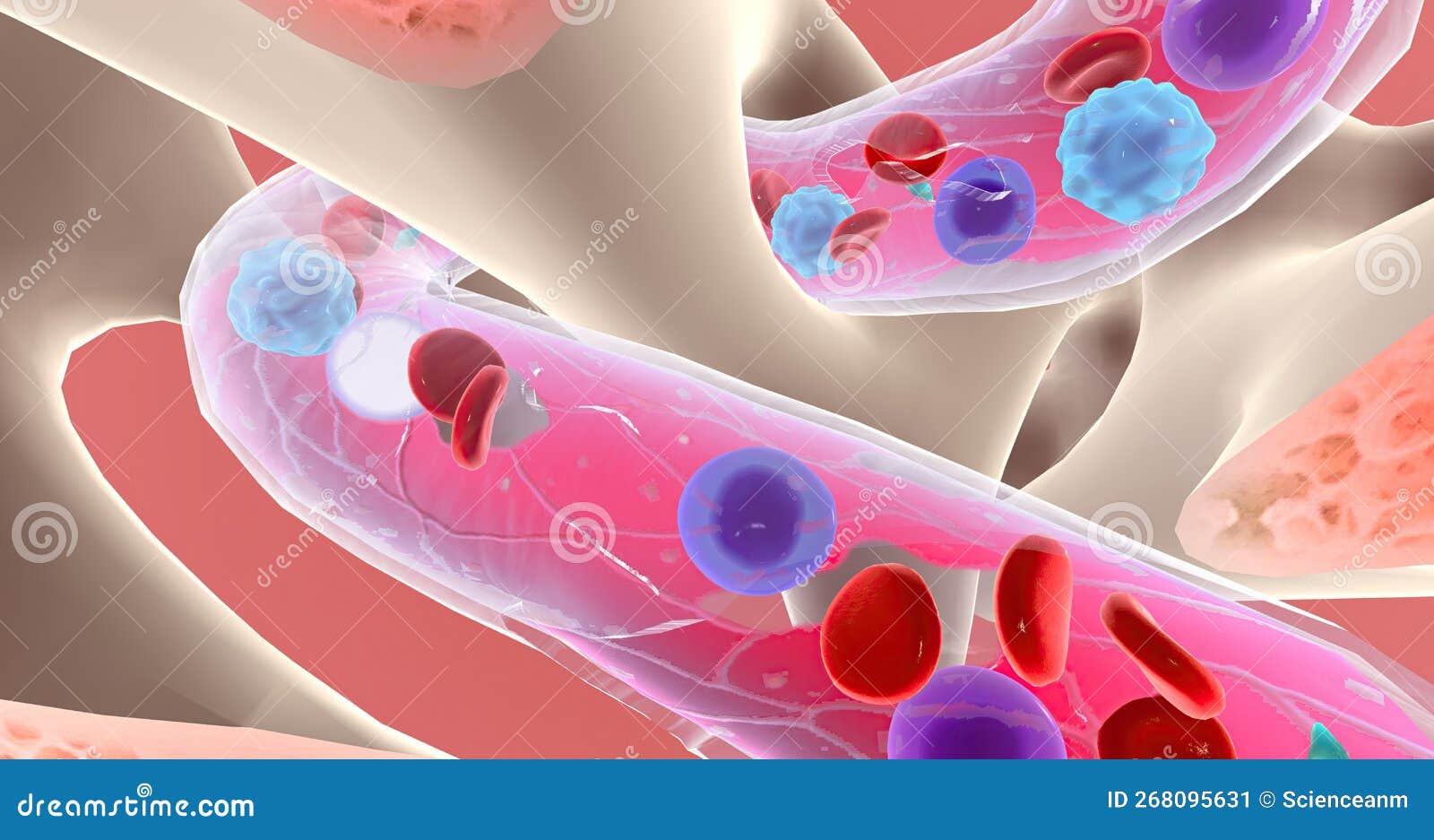 Lymphoblasts Invaded and Eventually Replace Healthy Bone Marrow ...