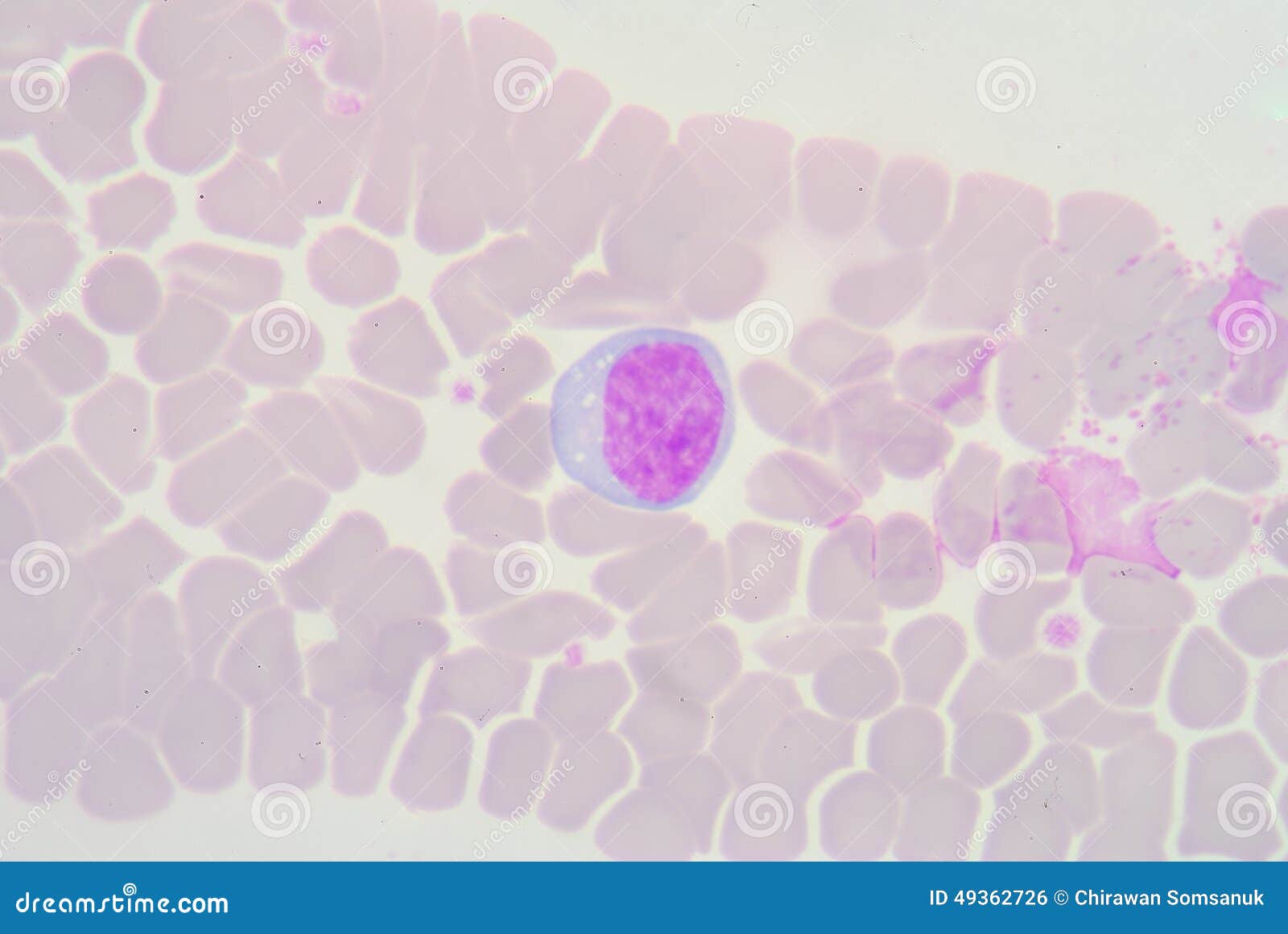 Lymphocyte stock photo. Image of hematology, human, cytoplasm - 49362726