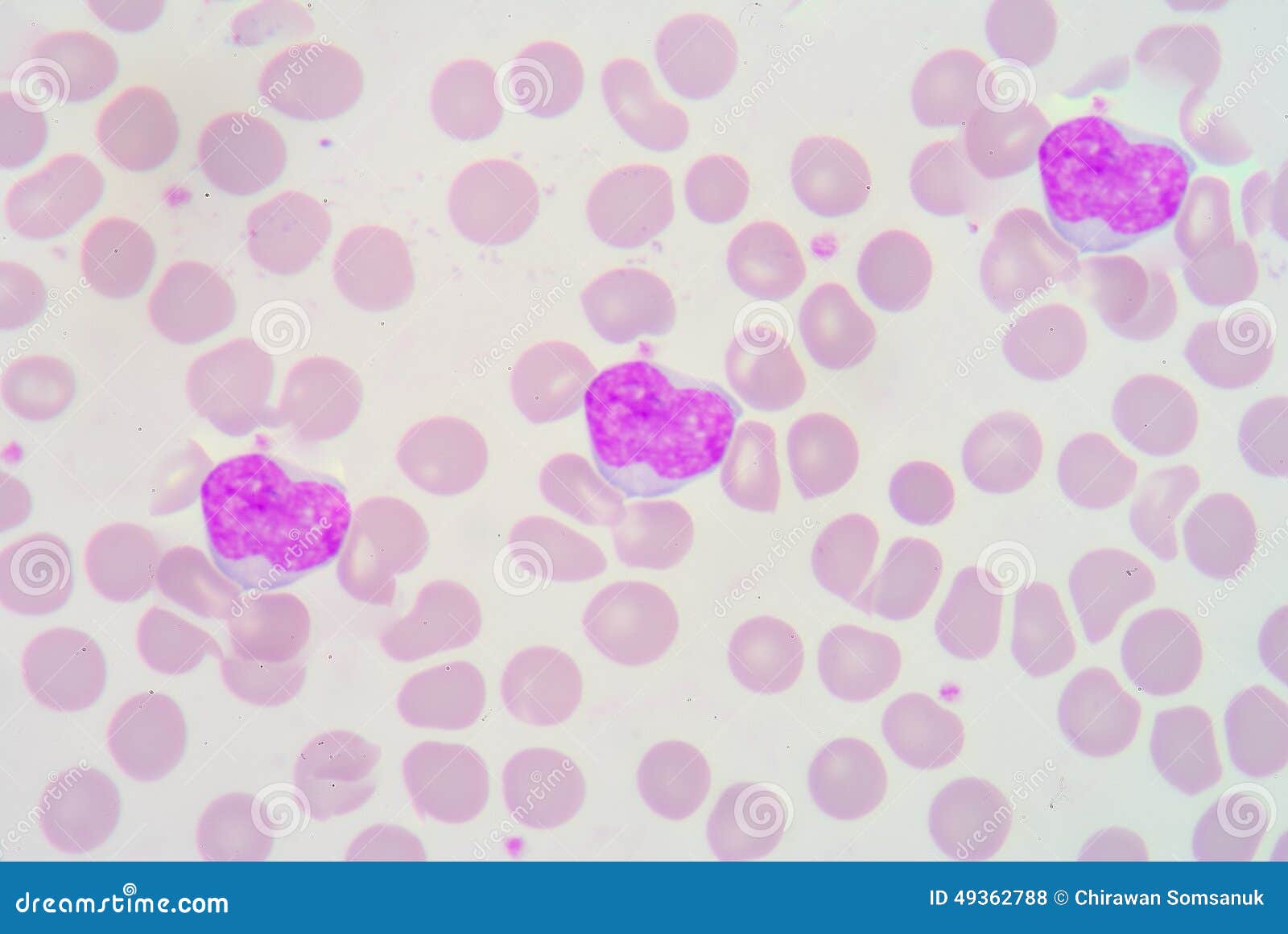 Lymphocyte stock photo. Image of immune, microbiology - 49362788