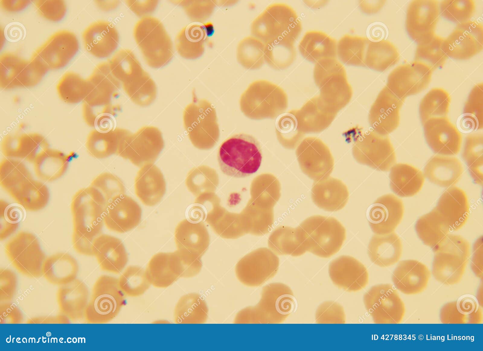 Lymphocyte Stock Photos - Download 934 Royalty Free Photos