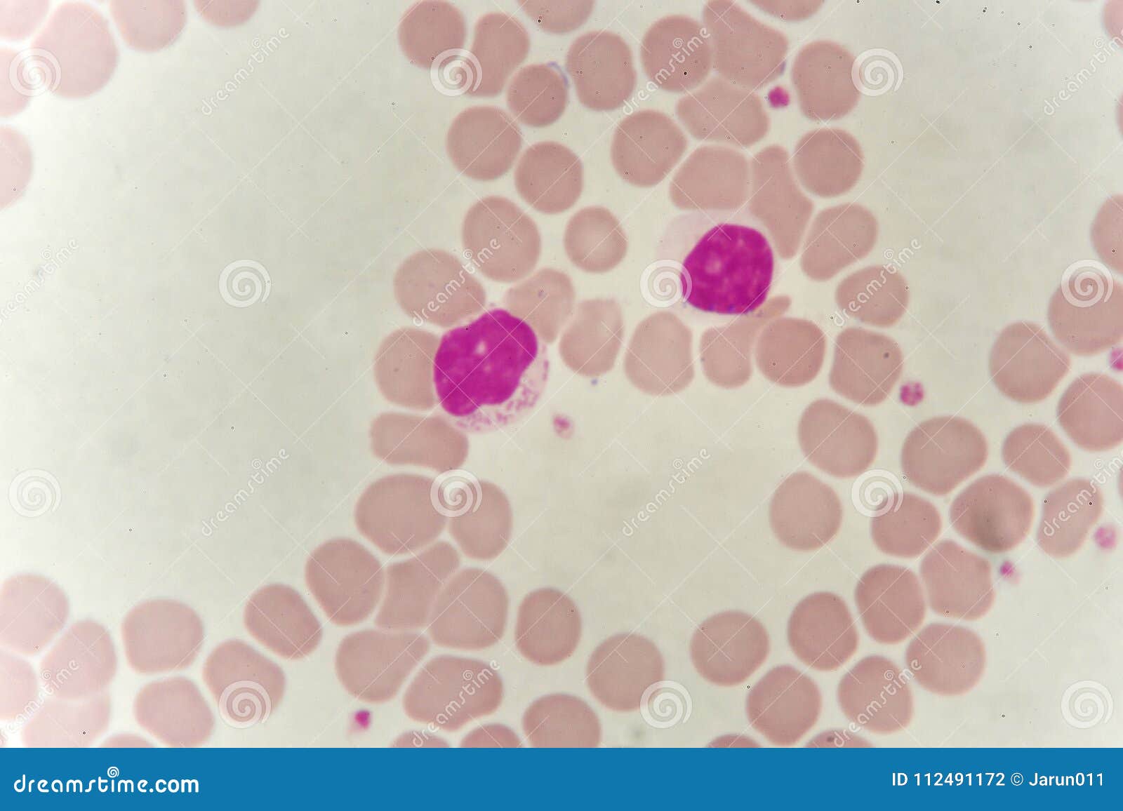 Lymphocyte Cell In Human Blood Smear Stock Image | CartoonDealer.com ...