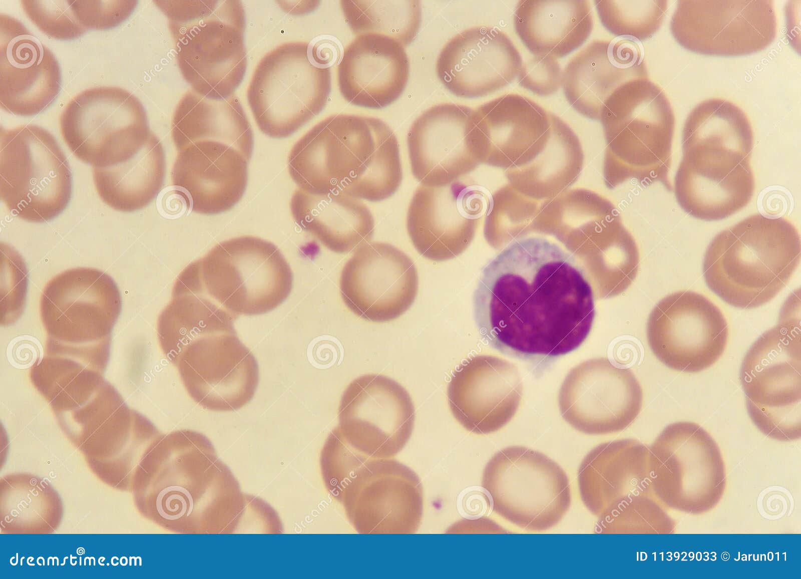 Lymphocyte Cell In Blood Smear Royalty-Free Stock Image | CartoonDealer ...