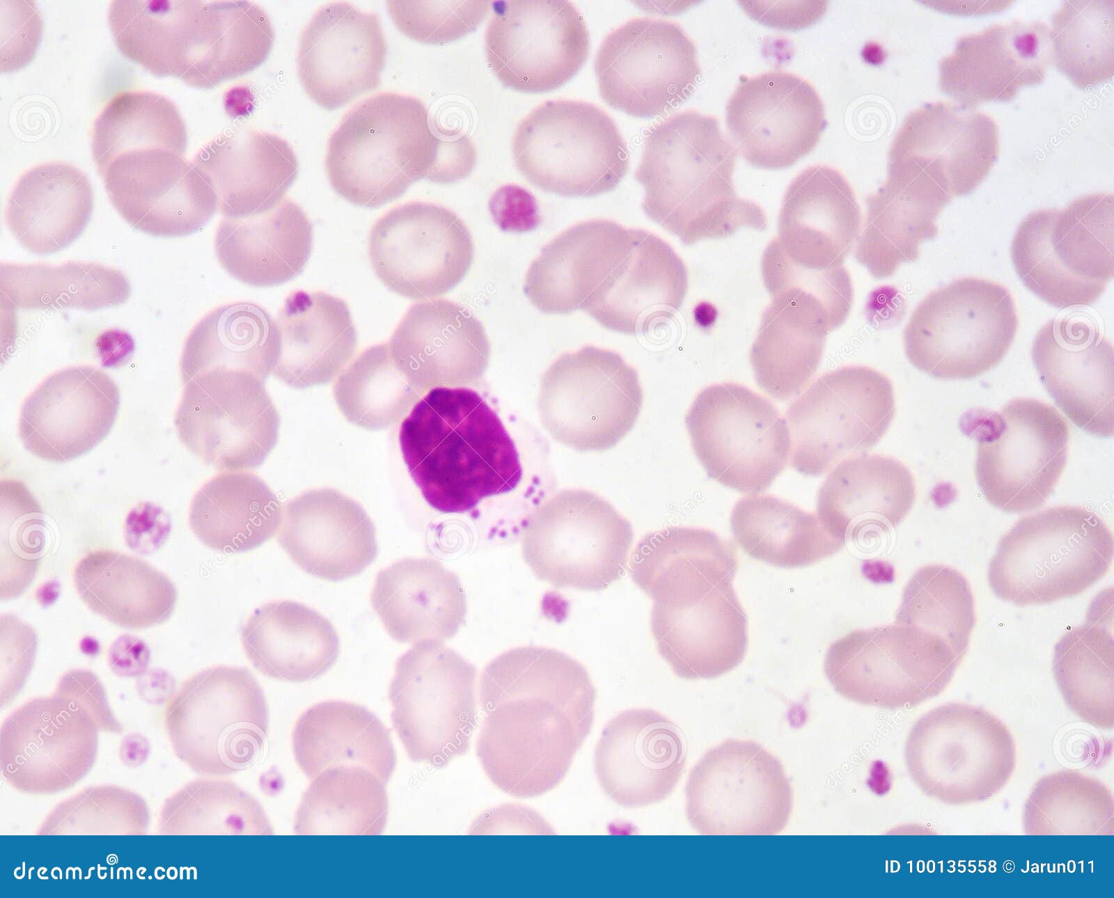 Lymphocyte cell stock photo. Image of laboratory, cells - 100135558