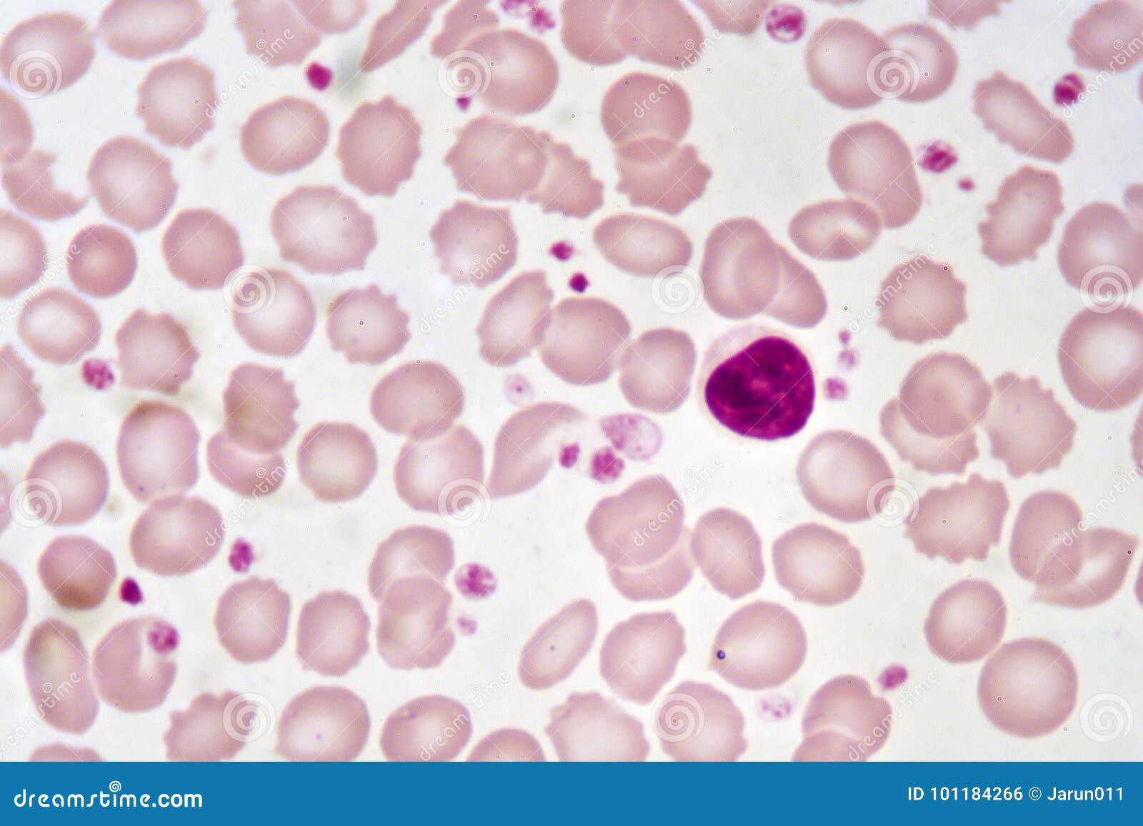 Lymphocyte Cell In Blood Smear Royalty-Free Stock Image | CartoonDealer ...