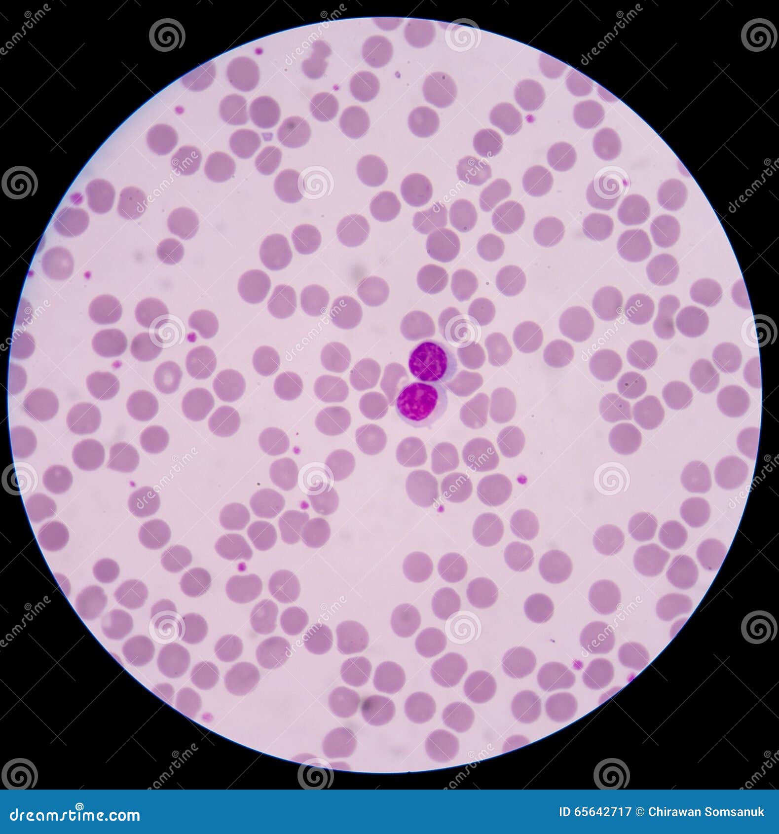 Lymphocyte Cells In Blood Smear Stock Image | CartoonDealer.com #126098983