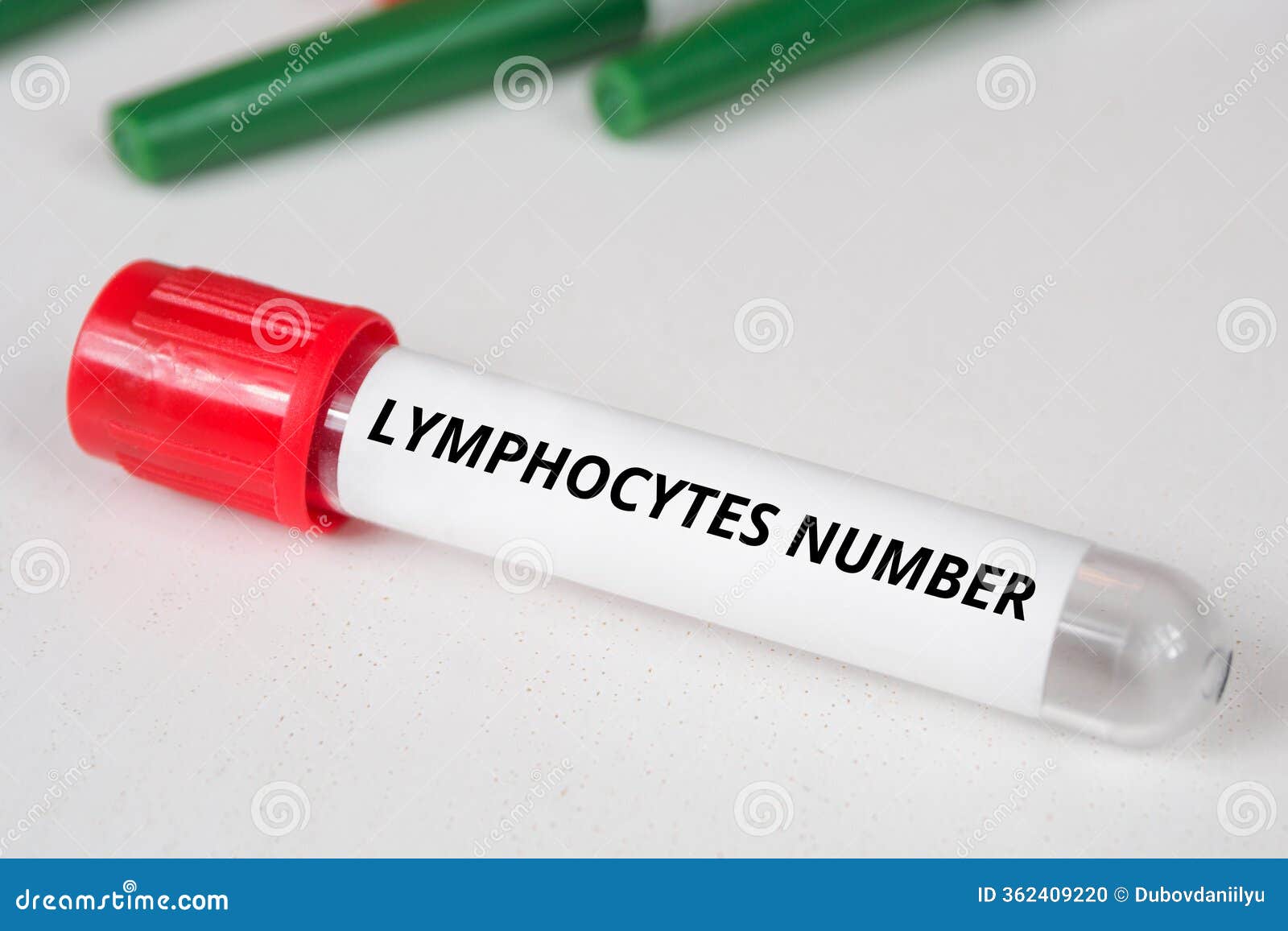 Lymphocytes Number Name of Blood Test Stock Photo - Image of ...