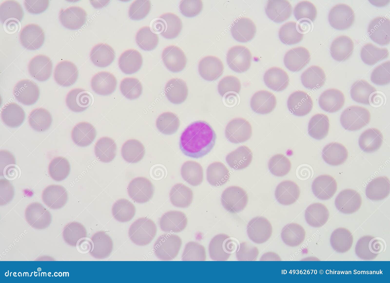 Lymphozyte stockfoto. Bild von granuliert, knochen, zytoplasma - 49362670
