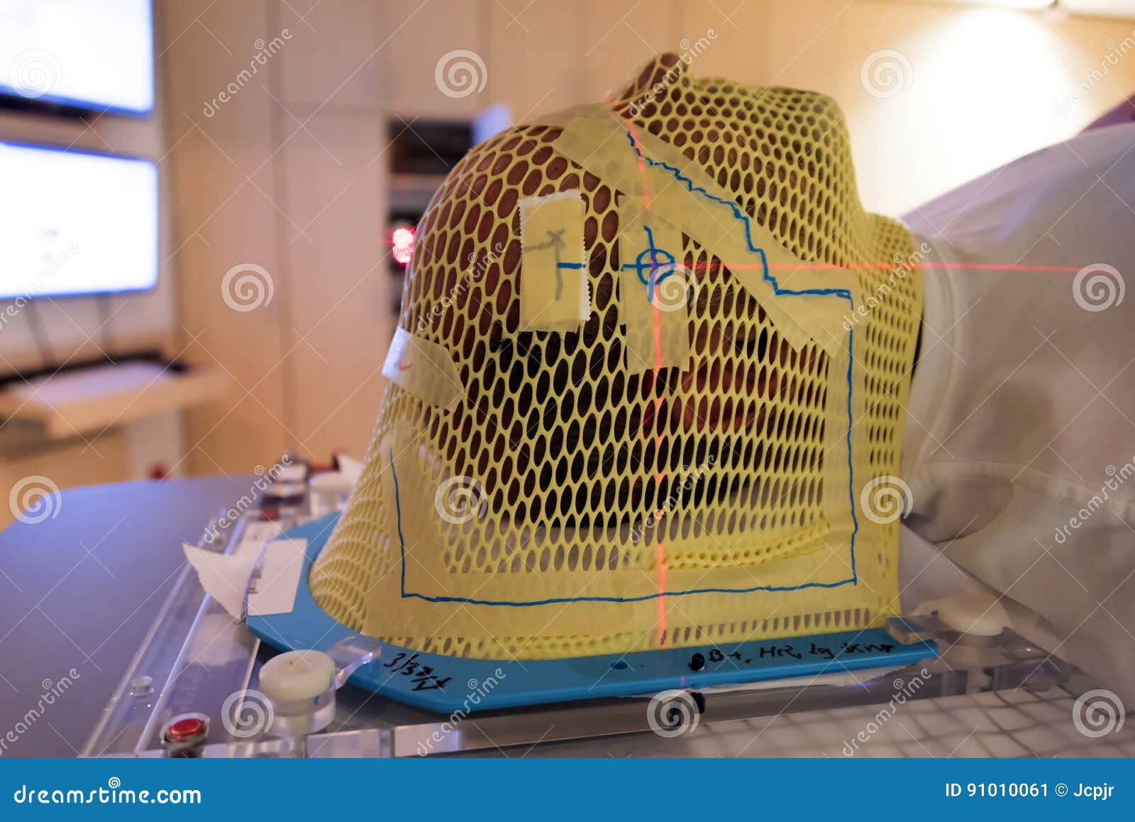 Máscara de la radioterapia imagen de archivo. Imagen de lineal - 91010061