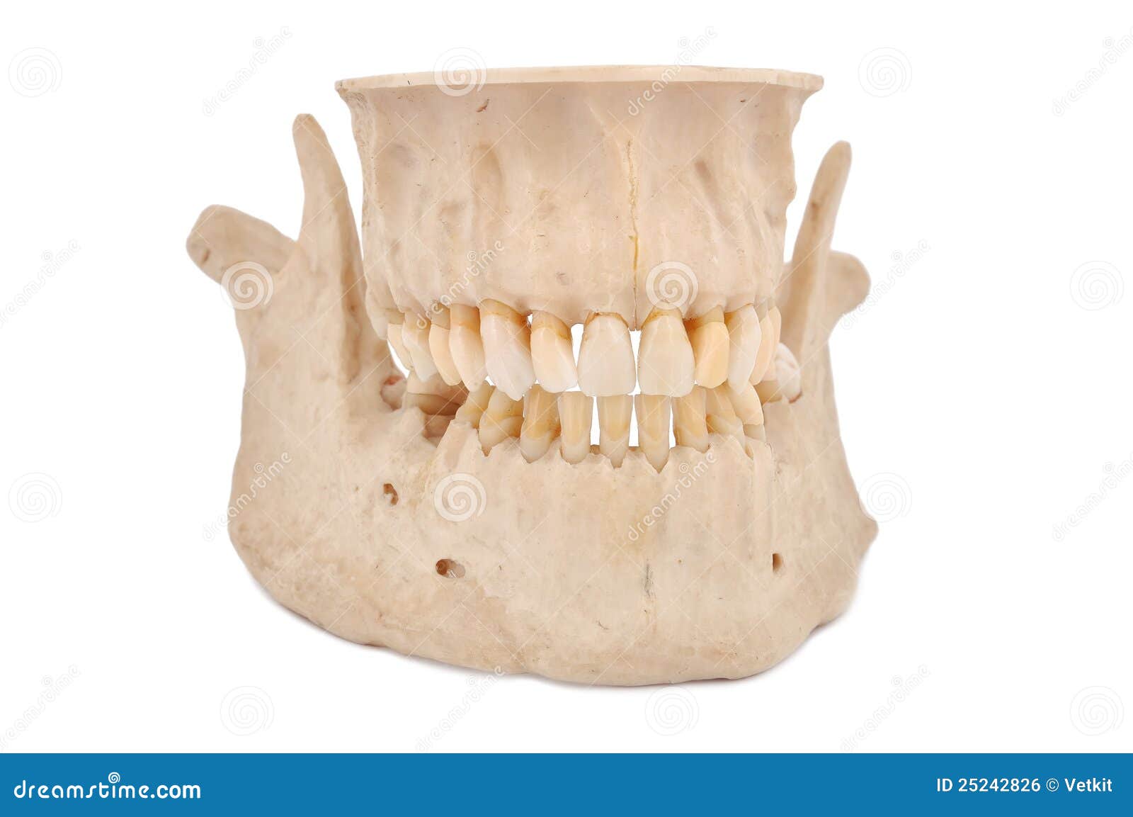 Mâchoire humaine photo stock. Image du insertion, laboratoire - 25242826