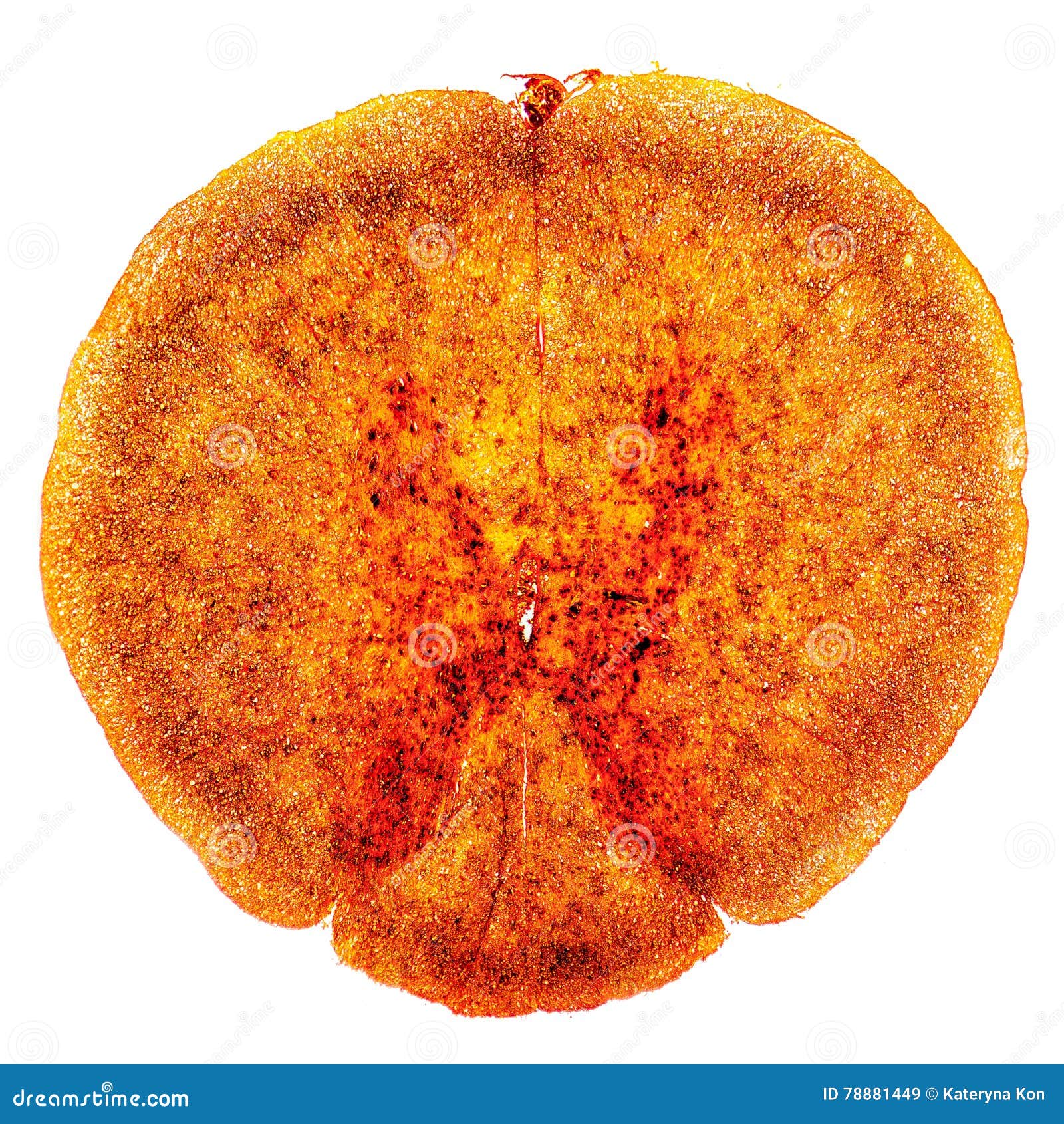 Médula Espinal, Corte Transversal Imagen de archivo - Imagen de ...