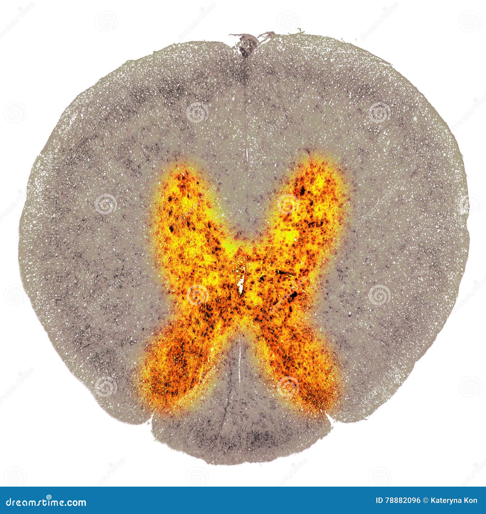 Médula Espinal, Corte Transversal Foto de archivo - Imagen de ...