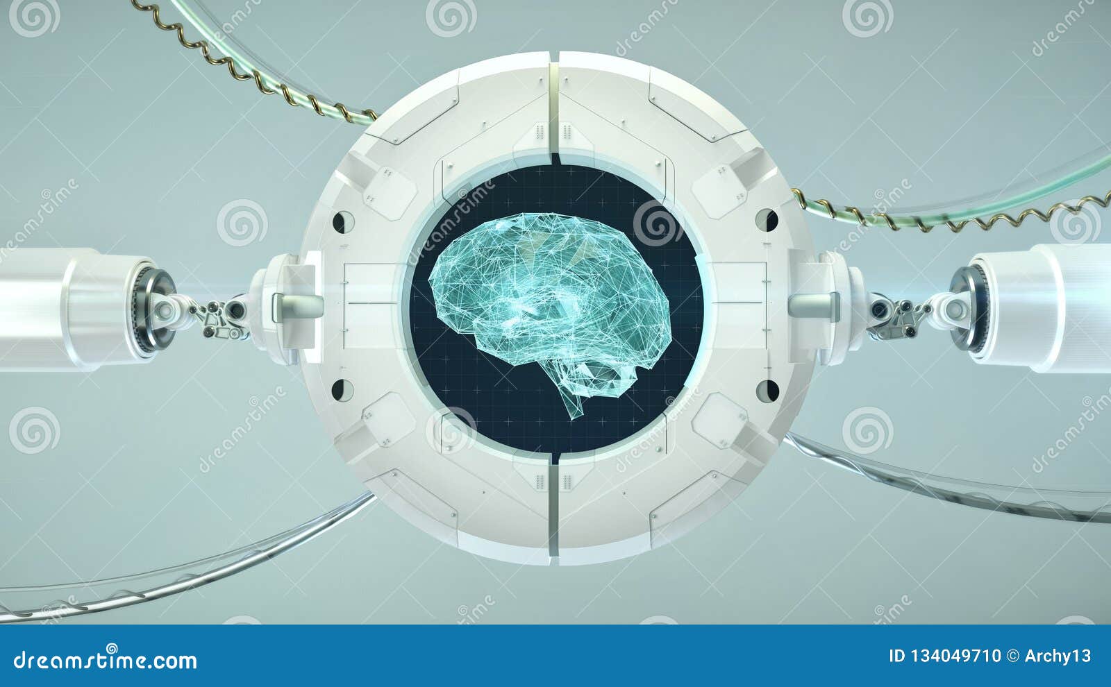 Deep Brain Stimulation Procedure Educational Explanation Outline ... Deep Brain Stimulation Procedure Educational Explanation Outline ...