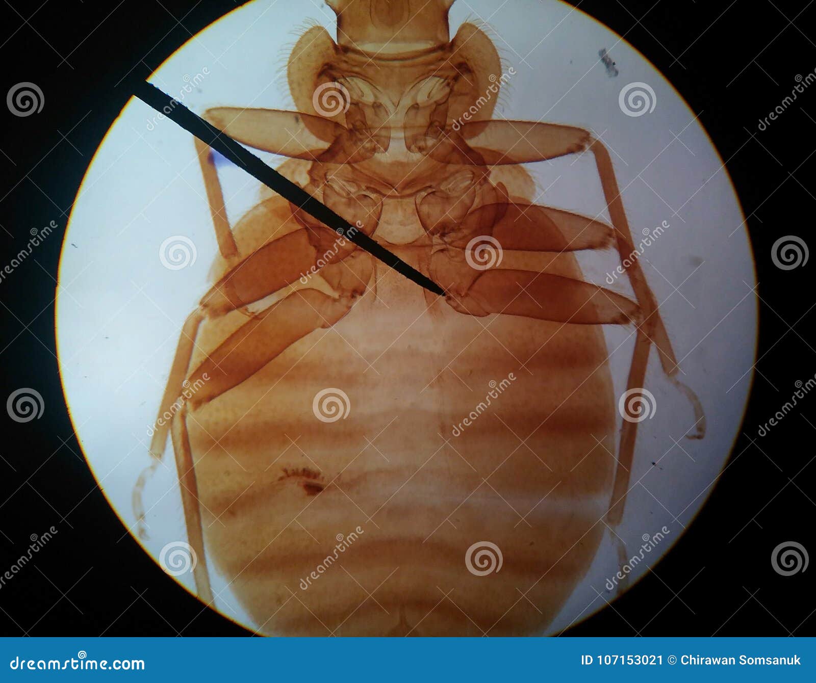 Macro Animal Parasite Find with Microscope. Stock Image - Image of skin ...