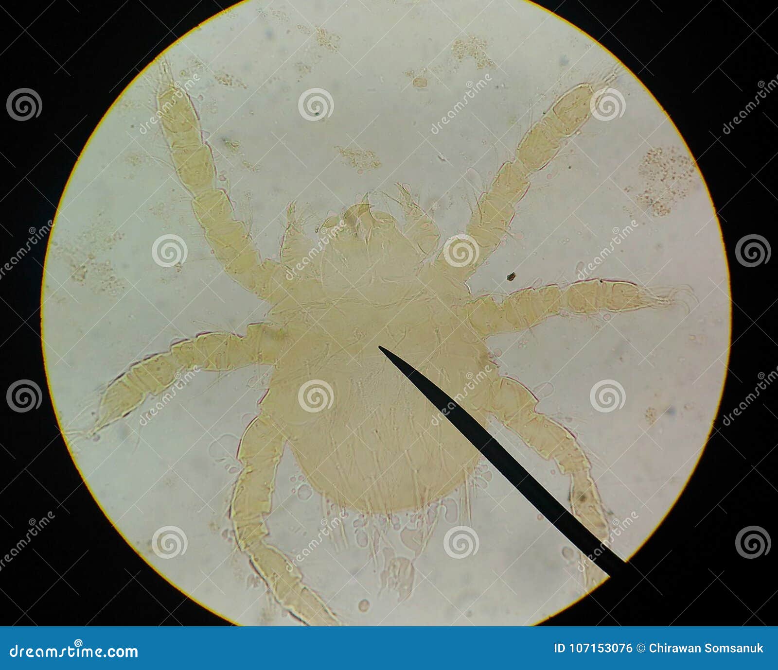 Macro Animal Parasite Find with Microscope. Stock Photo - Image of ...