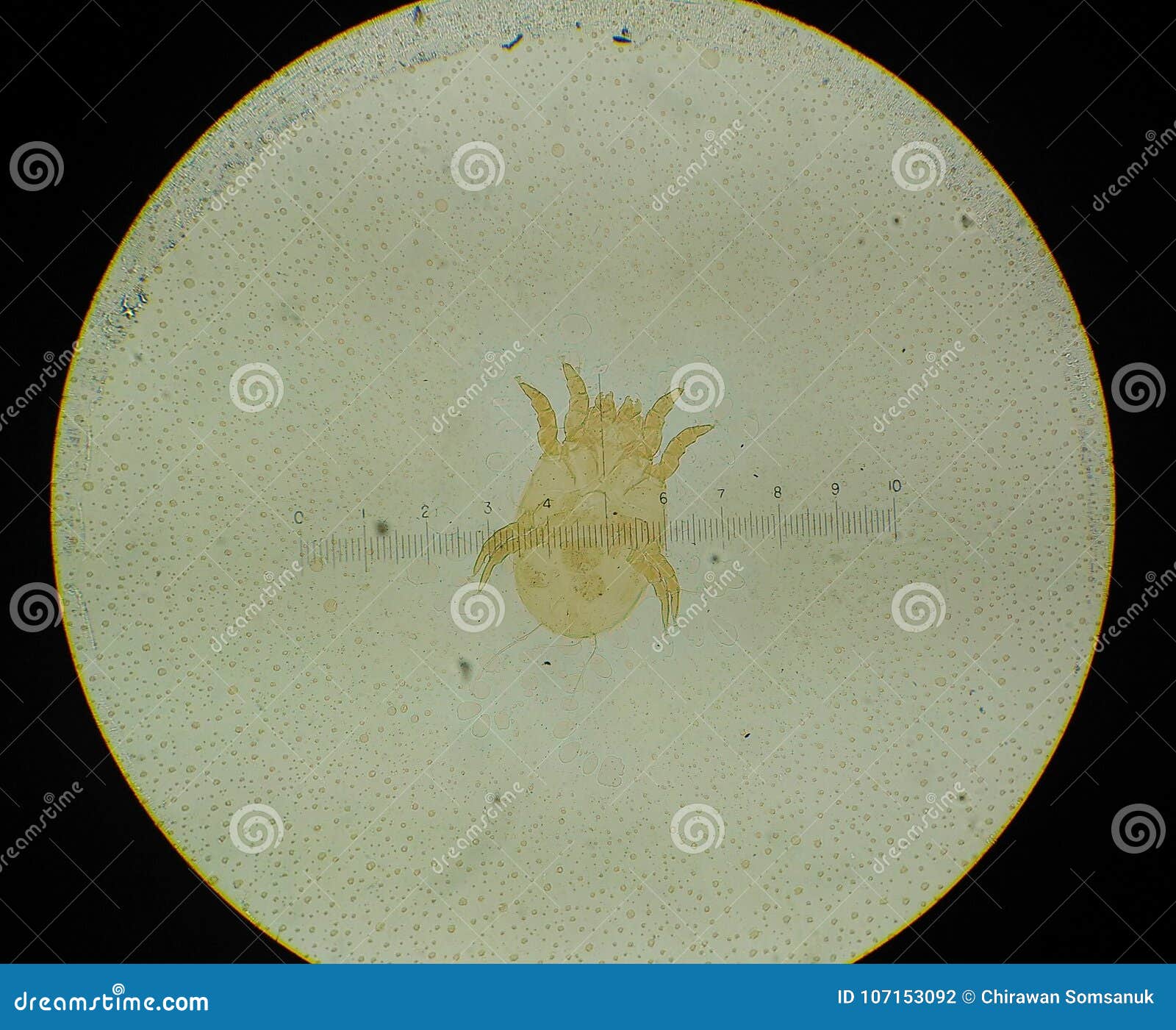 Macro Animal Parasite Find with Microscope. Stock Photo - Image of ...