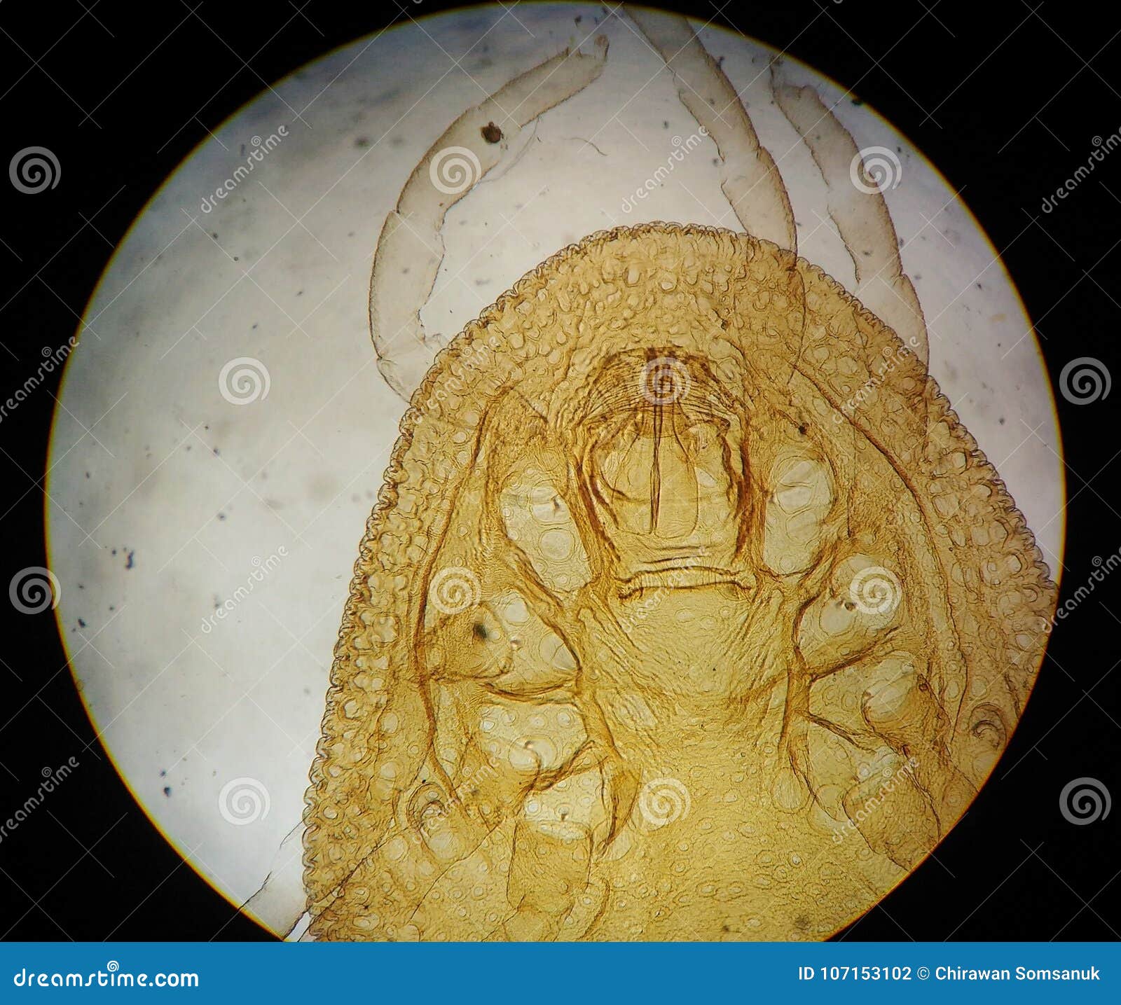 Macro Animal Parasite Find with Microscope. Stock Photo - Image of ...