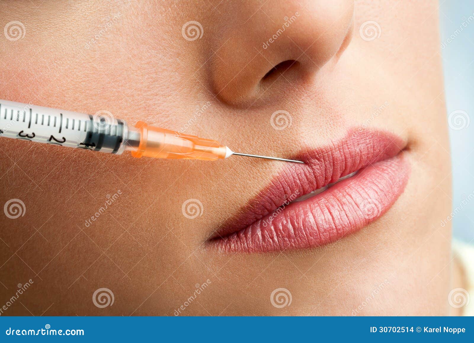 Macro Botox Syringe on Female Lips. Stock Photo - Image of therapy ...