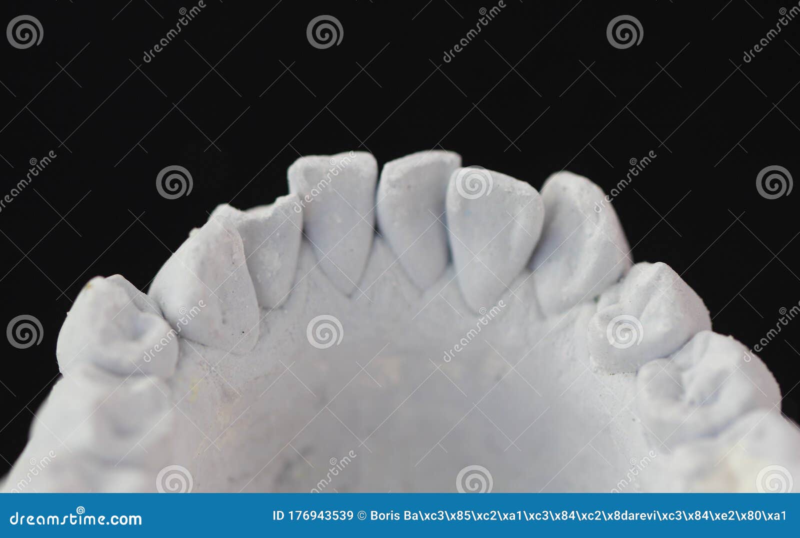Lower Front Incisor Baby Tooth Gap Showing Gums And Socket Stock Image ...