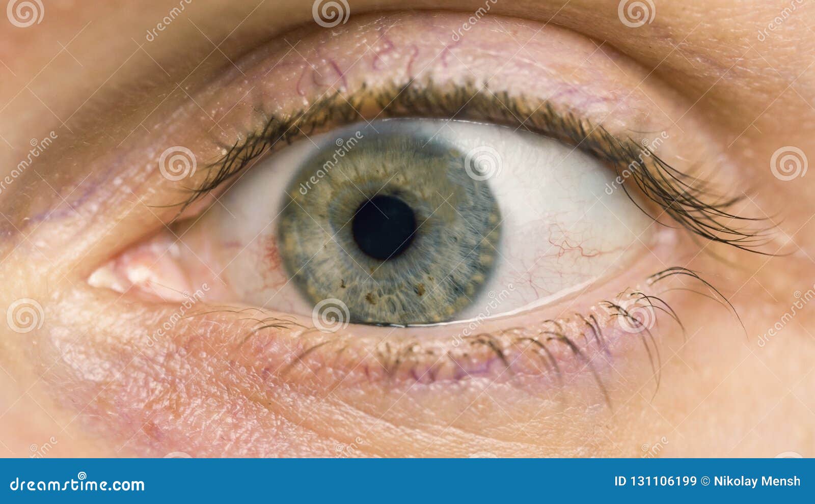 Macro D'oeil De Rouge De Conjonctivite Image stock - Image du eyeball ...